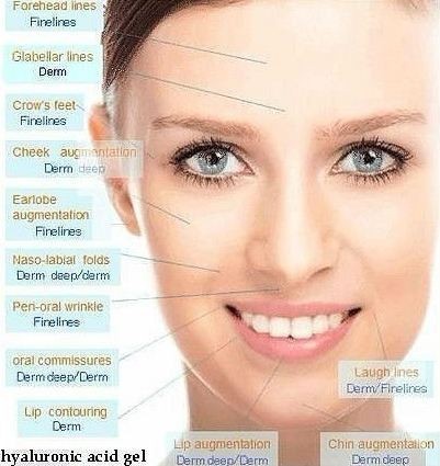 acid hialuronic injectabil | arhiva Okazii.ro