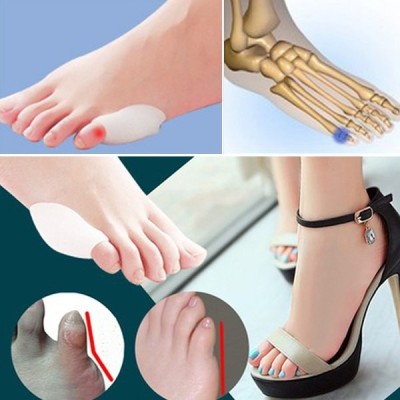 orteza deget mic orteze degete Hallux valgus picior corectie mont ...