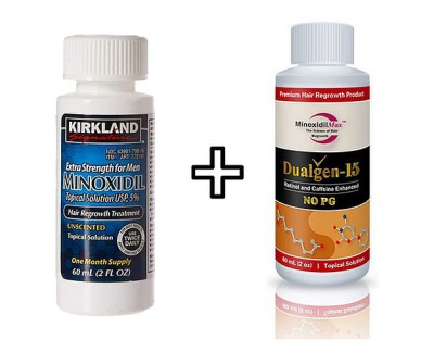 Minoxidil Dualgen 15% fara PG + Minoxidil Kirkland 5%, 2 luni aplicare ...