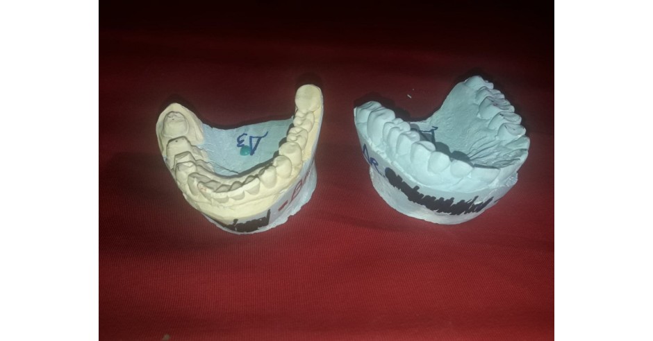 Model dentar gips, marime naturala, piesa stomatologica studiu, dantura ...