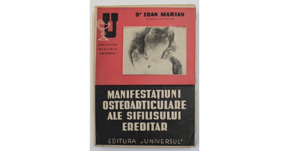 MANIFESTATIUNI OSTEOARTICULARE ALE SIFILISULUI EREDITAR de Dr. IOAN MARIAN , 1945 | Okazii.ro