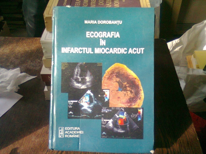 ECOGRAFIA IN INFARCTUL MIOCARDIC ACUT - MARIA DOROBANTU | arhiva Okazii.ro
