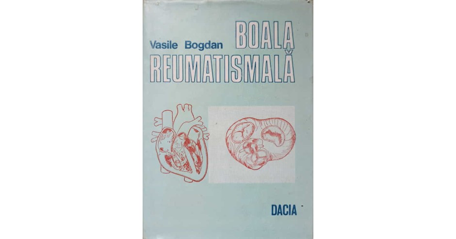 Boala Reumatismala - Vasile Bogdan, Editura Dacia 1986, Medicina ...