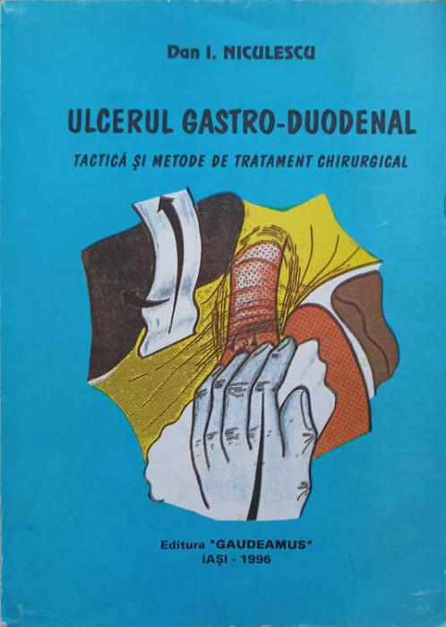 ULCERUL GASTRO-DUODENAL. TACTICA SI METODE DE TRATAMENT CHIRURGICAL-I ...
