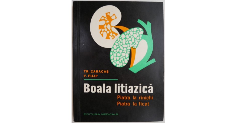 Boala litiazica piatra la rinichi piatra la ficat ? Tr. Caracas ...